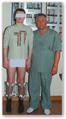 Surgery to Become Taller – Cosmetic Limb Lengthening (CLL) - Medical Quack